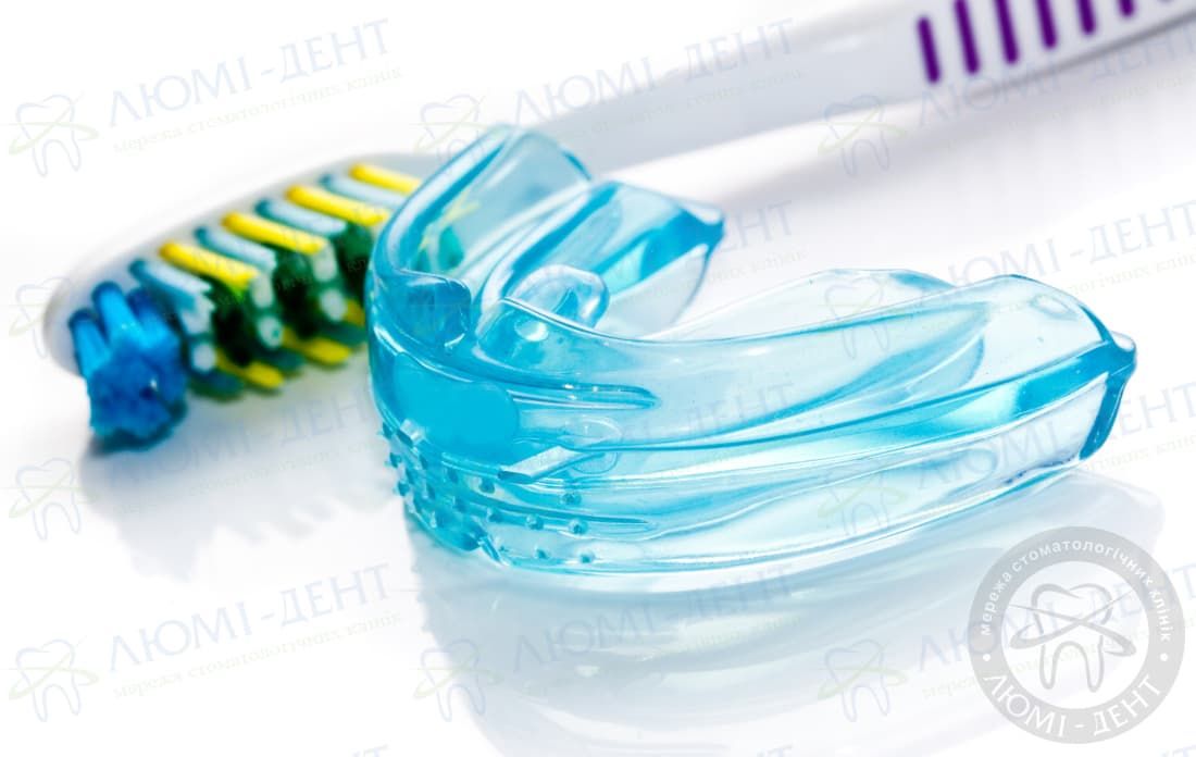 Капы для отбеливания зубов🦷Что это?🦷ЛюмиДент